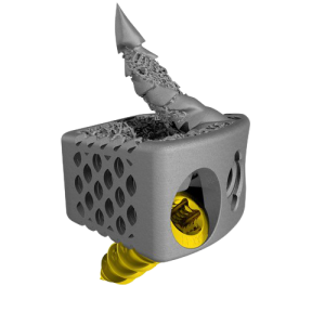 CORELINK ANNOUCES FIRST OF ITS KIND FUSATION™ 3D PRINTED CERVICAL ...