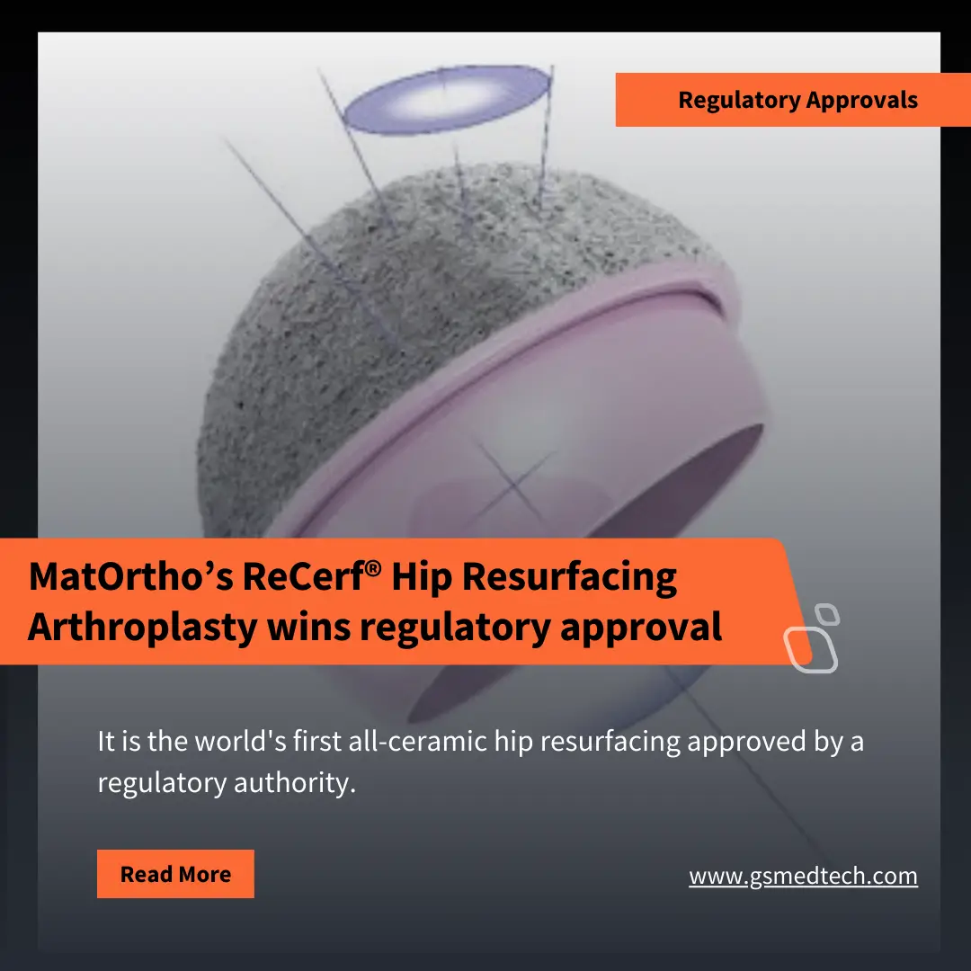 MatOrtho’s ReCerf® Hip Resurfacing Arthroplasty wins regulatory approval