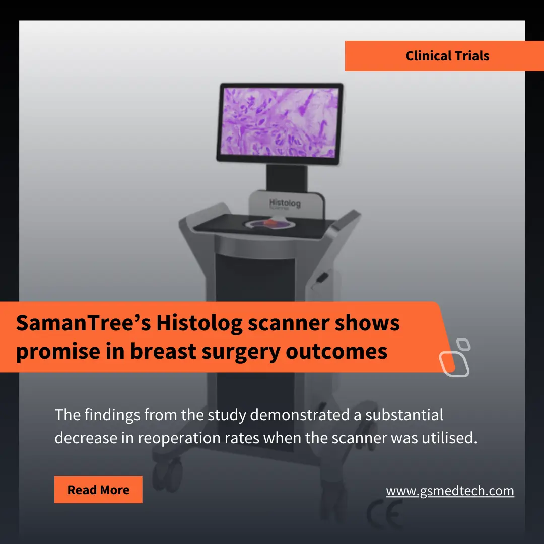 SamanTree Medical’s Histolog scanner shows promise in breast surgery ...