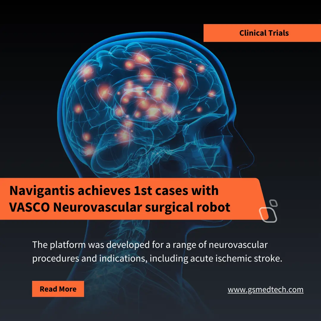 Navigantis achieves 1st cases with VASCO Neurovascular surgical robot