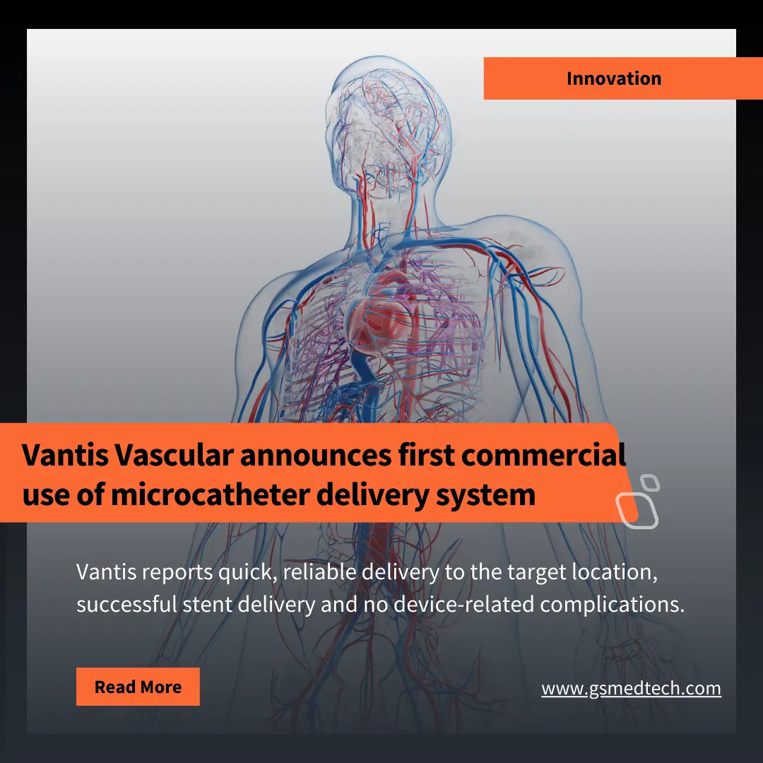 Vantis Vascular announces first commercial use of microcatheter ...