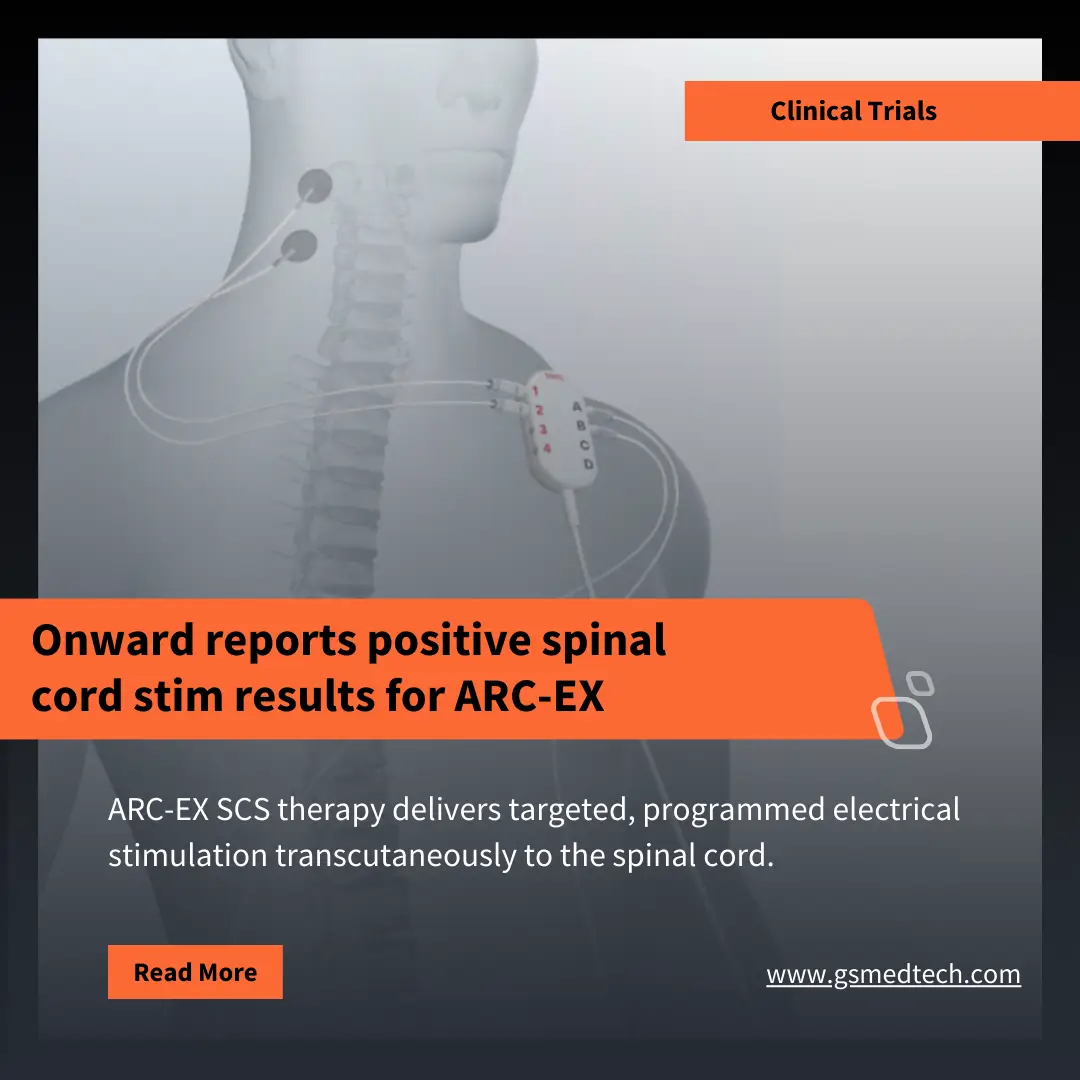 Onward reports positive spinal cord stim results for ARC-EX