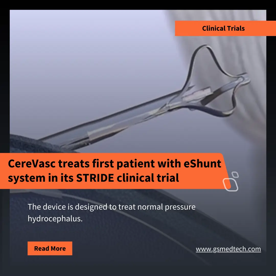CereVasc treats first patient with eShunt system in its STRIDE clinical ...
