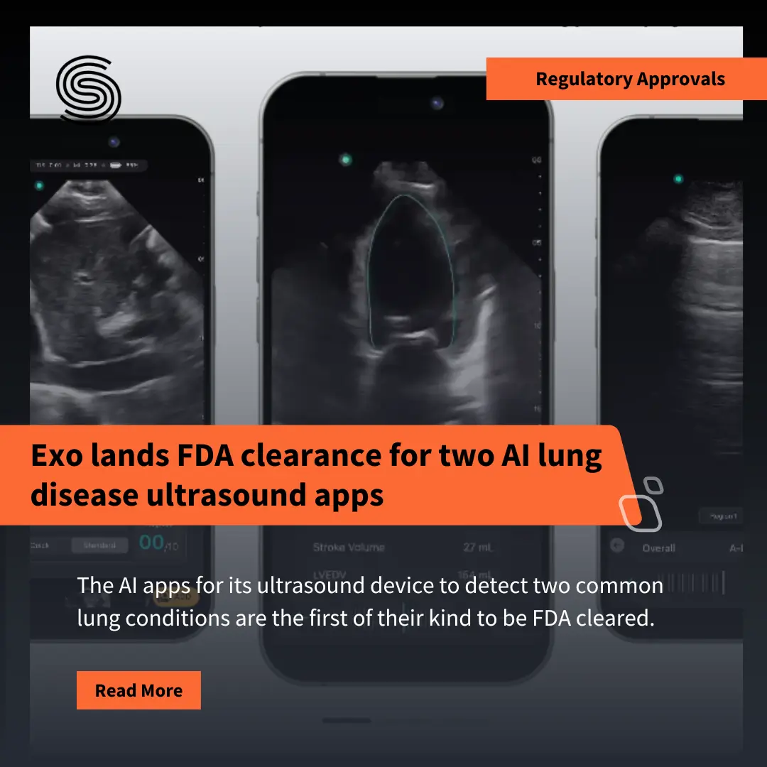 Exo lands FDA clearance for two AI lung disease ultrasound apps